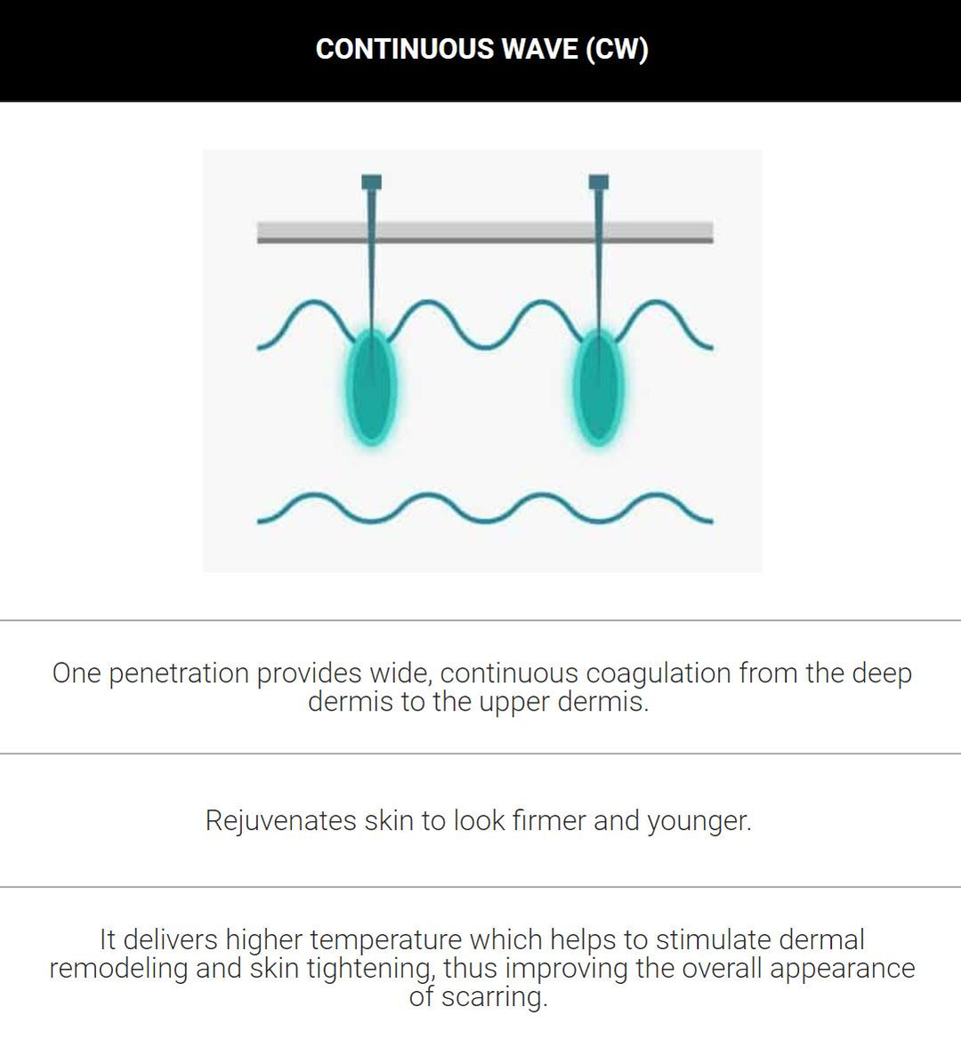 RF Microneedling Guide: Unveil the Secret to Radiant Skin in 2024 ...