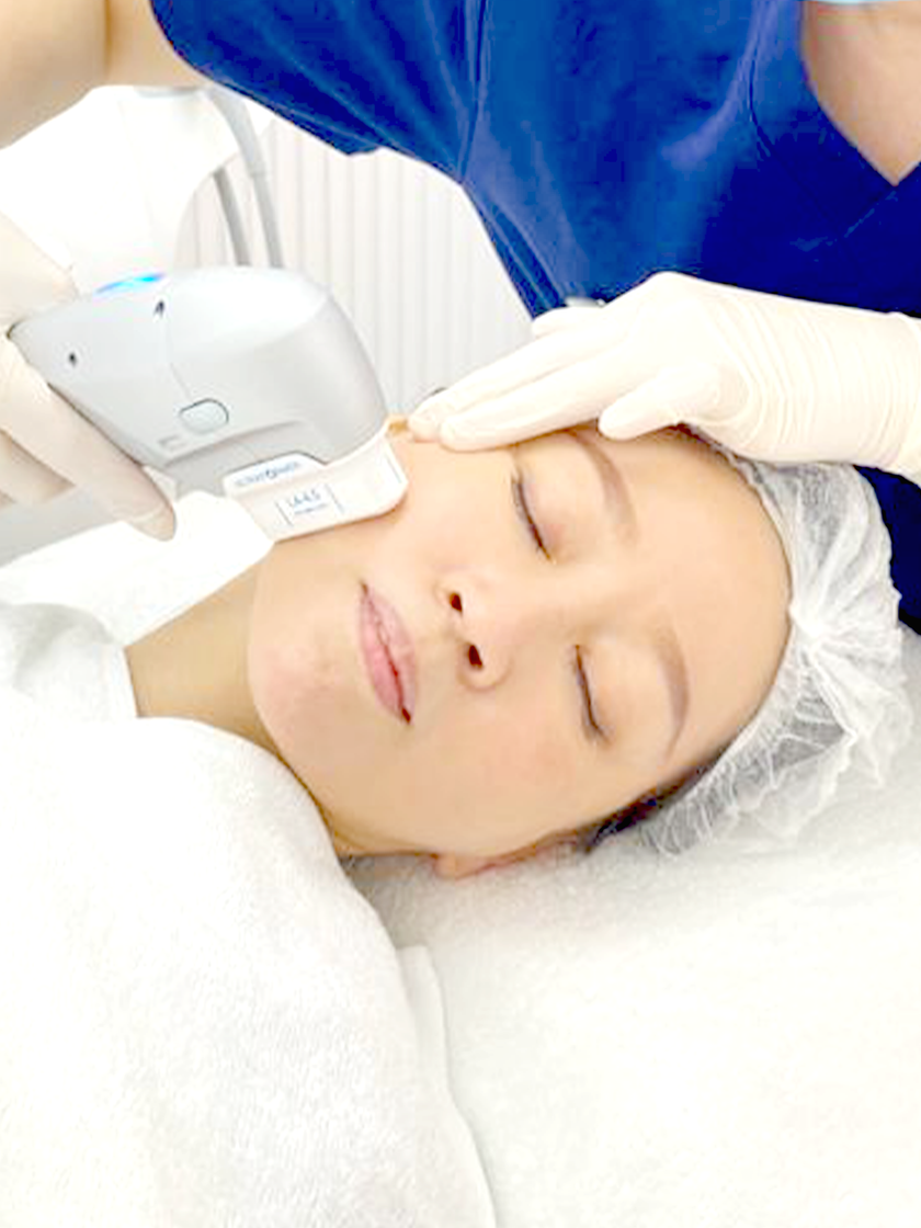 HIFU Treatment Skin Tightening Technology Insights - IMAGO Aesthetic